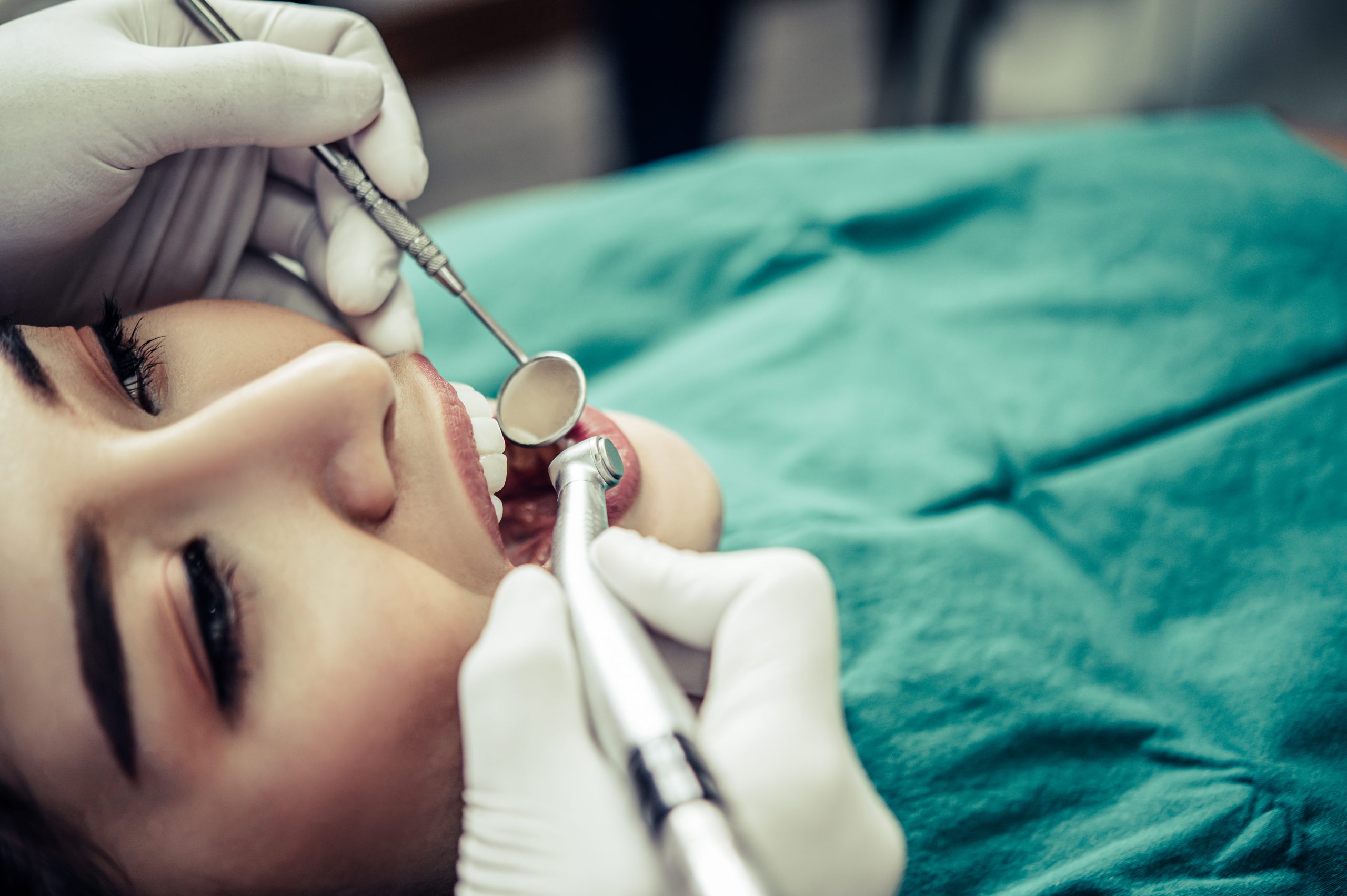 Frenectomy, Tongue Tie Melbourne | Rosanna Family Dental Clinic ...